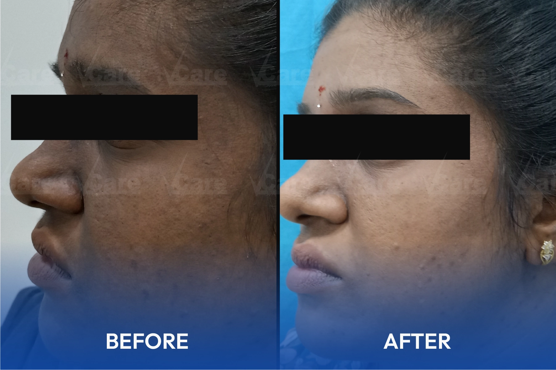 Vcare Trichology - Skin and Hair Treatment