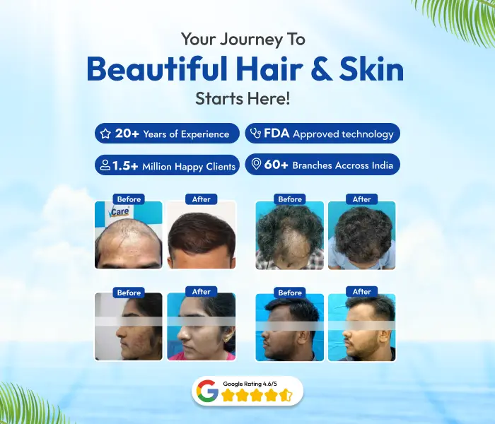 Vcare Trichology - Hair Treatment and Skin Treatment