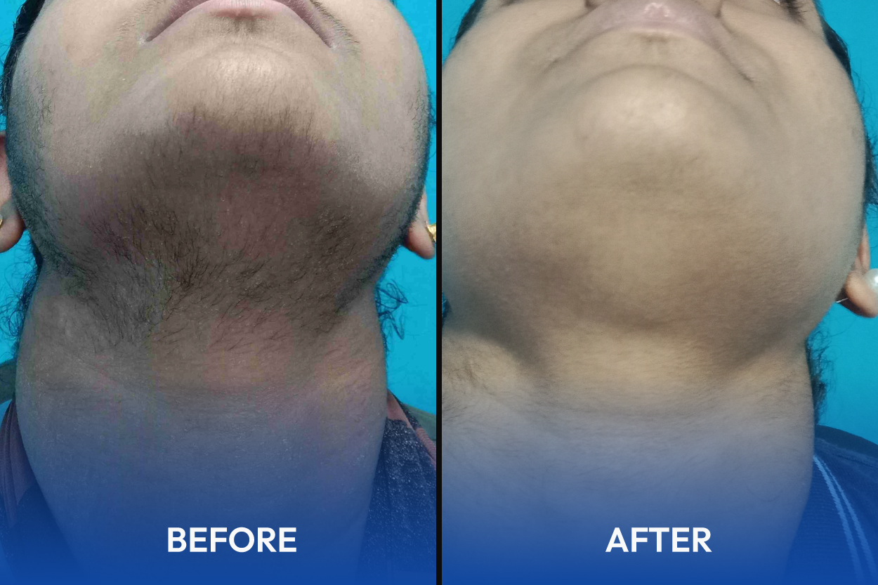 Vcare Trichology - Skin and Hair Treatment